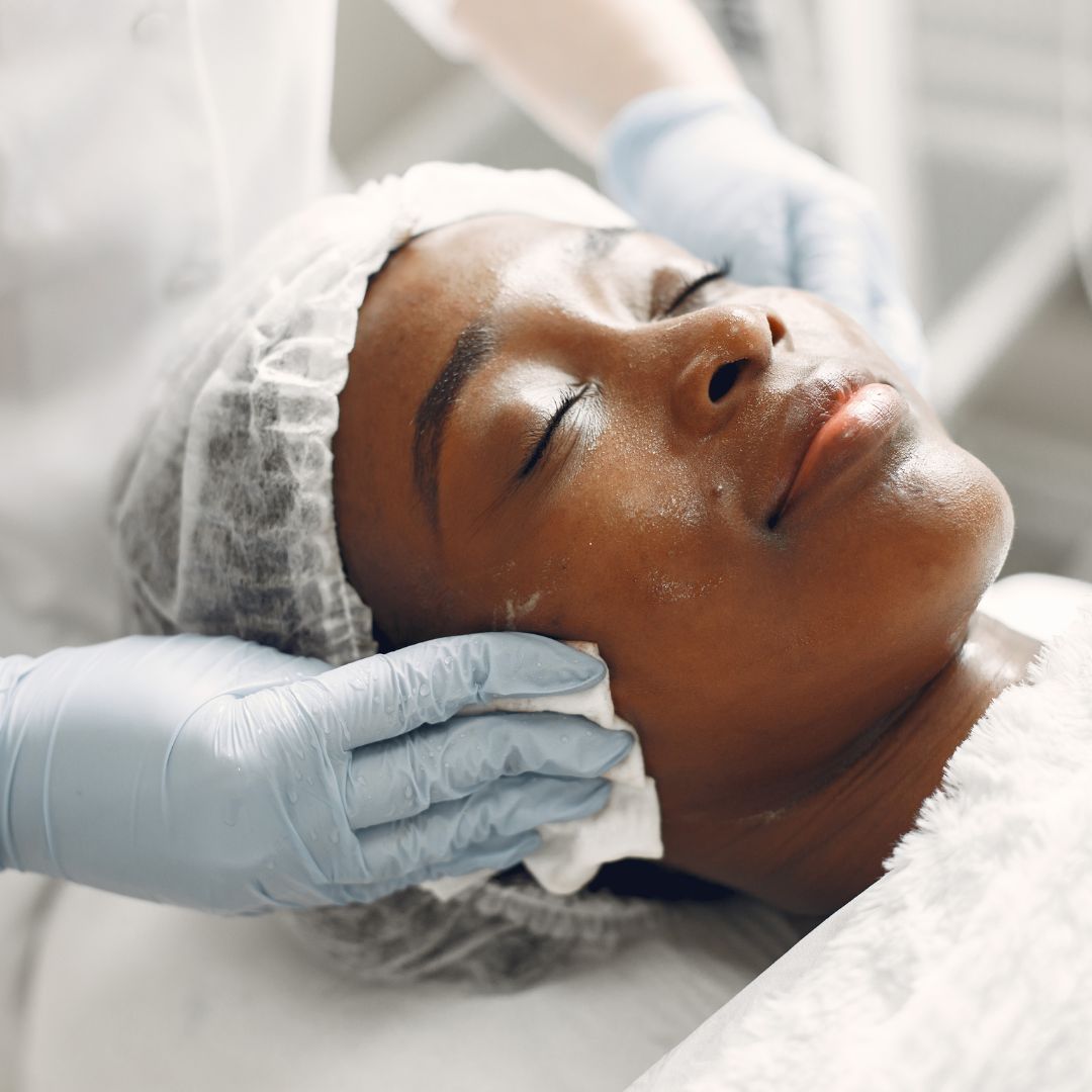 BioRePeel Blue: TCA "No-Peel" Chemical Peel | Upstate SC
